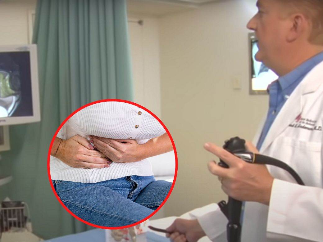 Karcinom debelog creva i polipi | Lepa i srećna