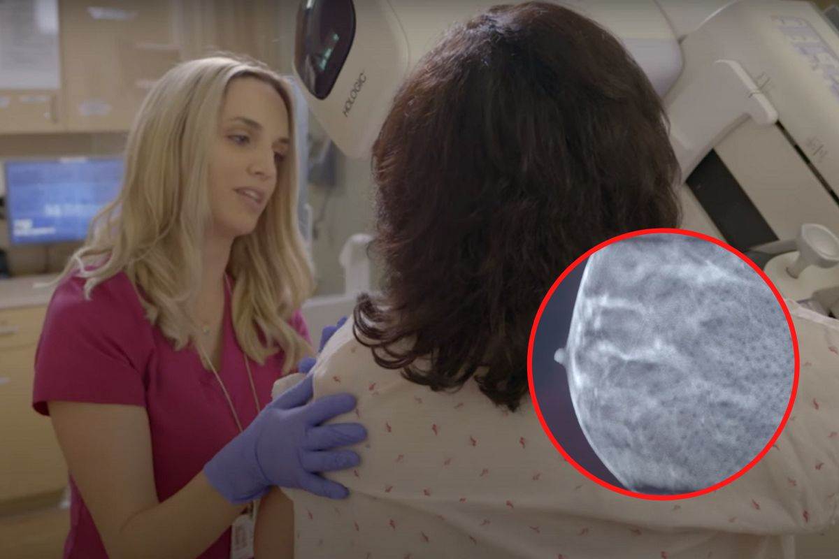 Karcinom dojke i vrste simptomi | Lepa i srećna