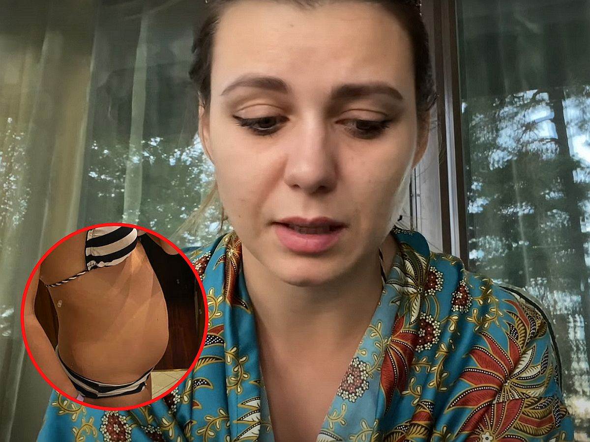 Čišćenje Organizma Od Parazita Iskustva Lepa I Srećna