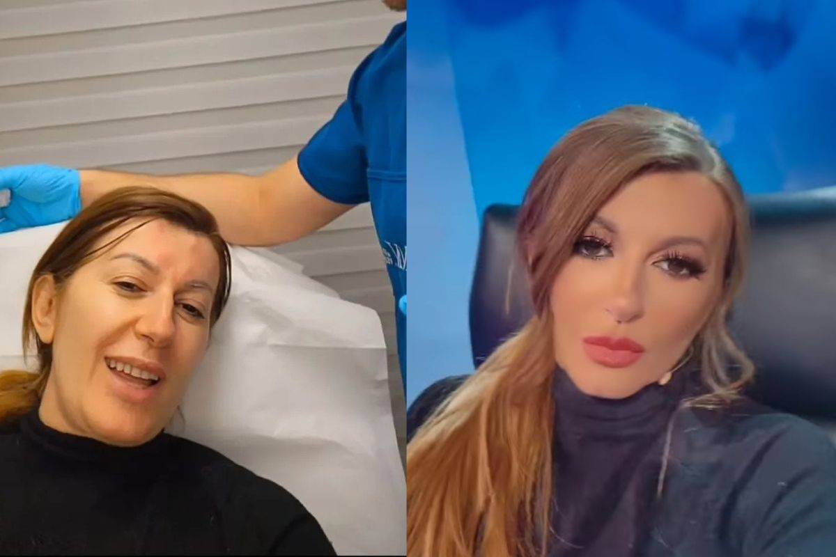 Viki Miljković na botoksu | Lepa i srećna