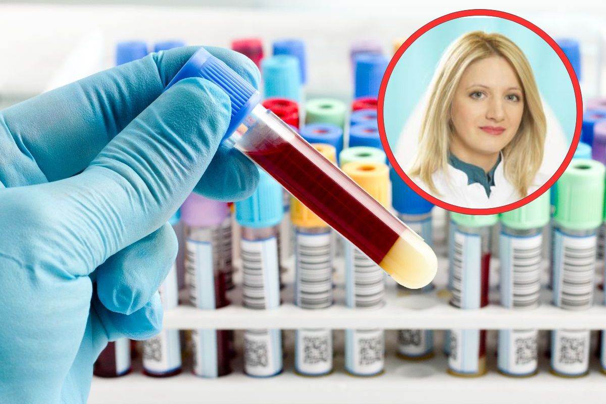 Krvna slika anemije koliko čuvati rezultate laboratorije | Lepa i srećna