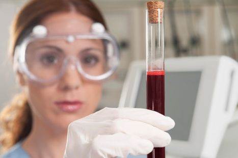 glukoza u krvi vrednosti | Lepa i srećna