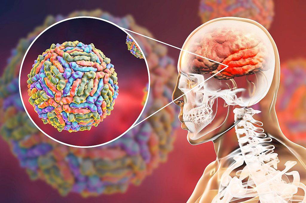 GROZNICA ZAPADNOG NILA: simptomi, inkubacija, dijagnoza i lečenje ...