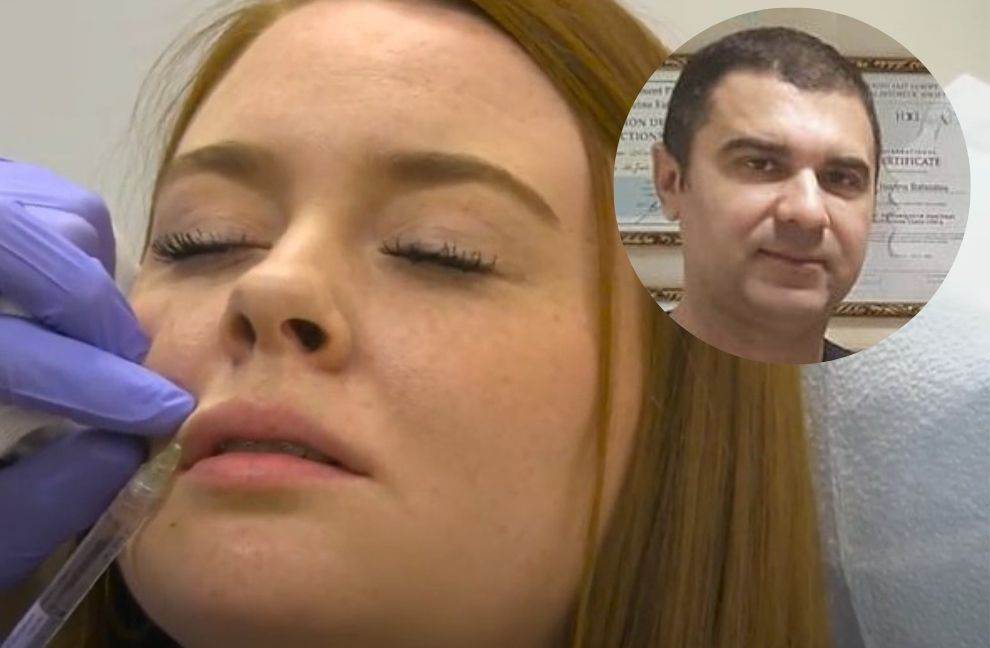 vladimir arsenijevic usne hijaluron biopolimer | Lepa i srećna